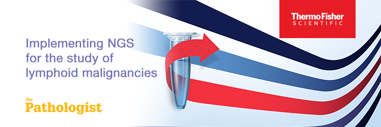 Implementing NGS for the study of lymphoid malignancies Registration